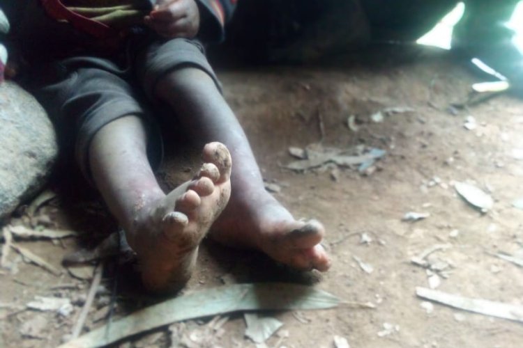 Musanze: Nyakatsi yo kuburiri intandaro y'amavunja adacika kubasigajwe ...