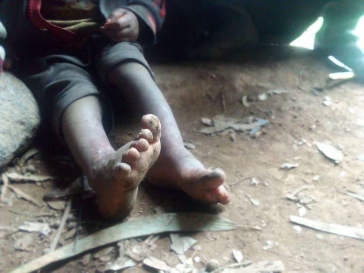 Musanze: Nyakatsi yo kuburiri intandaro y'amavunja adacika kubasigajwe ...